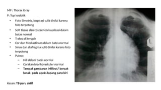Contoh Soal-Soal Koas Radiologi Matrikulasi | PPTX