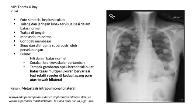 Contoh Soal-Soal Koas Radiologi Matrikulasi | PPT
