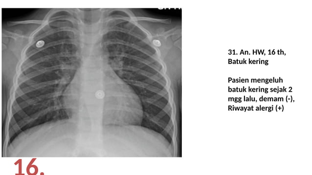 Contoh Soal-Soal Koas Radiologi Matrikulasi | PPT