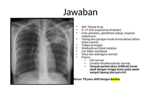 Contoh Soal-Soal Koas Radiologi Matrikulasi | PPTX