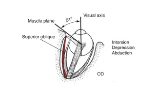 anatomía del oblicuo superior imagen y localizacion | PPTX