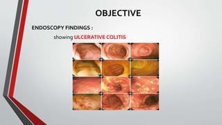 SOAP ON TYPHOID FEVER | PPT