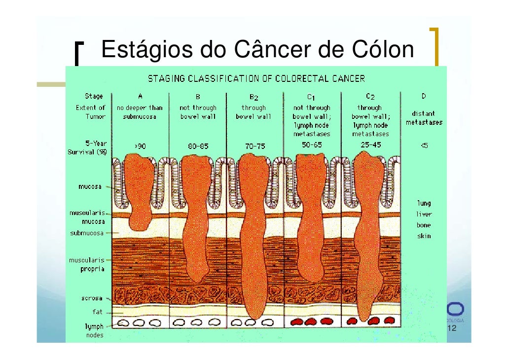 Sobrafo 2009 Cancer De Colon Carlos F Pinto