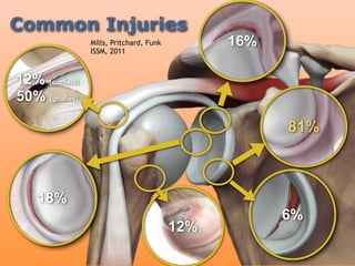 Soccer Shoulder - Lennard Funk | PDF