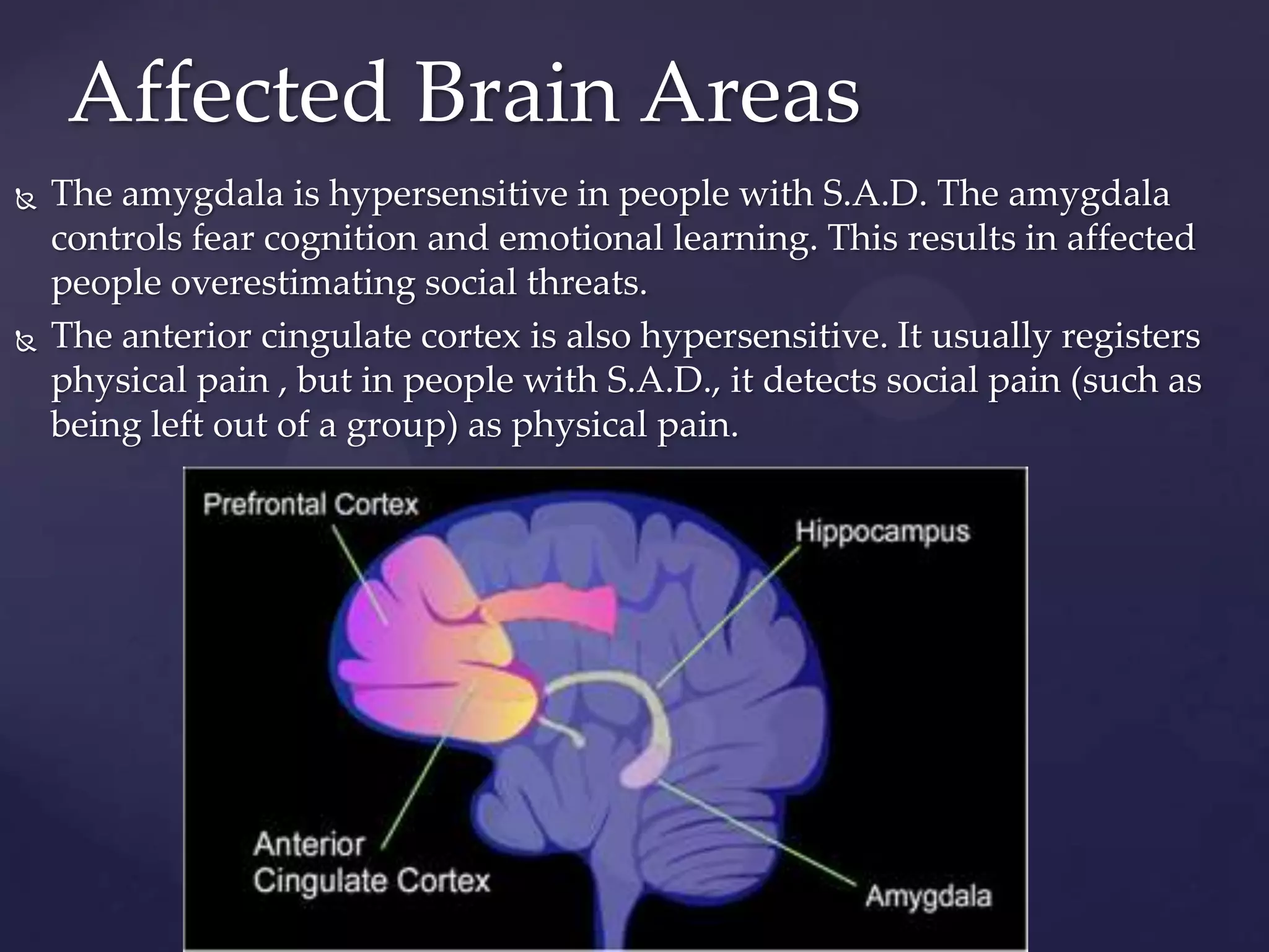 Social Anxiety Disorder | PPTX