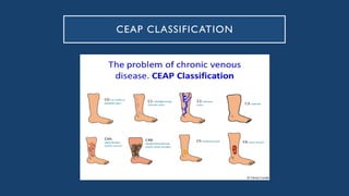 "Socio-Economic Burden of Venous Diseases in India: A Growing Public ...