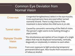receiving mechanism | PPTX