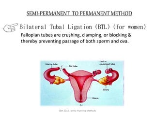 Family Planning Methods | PPT