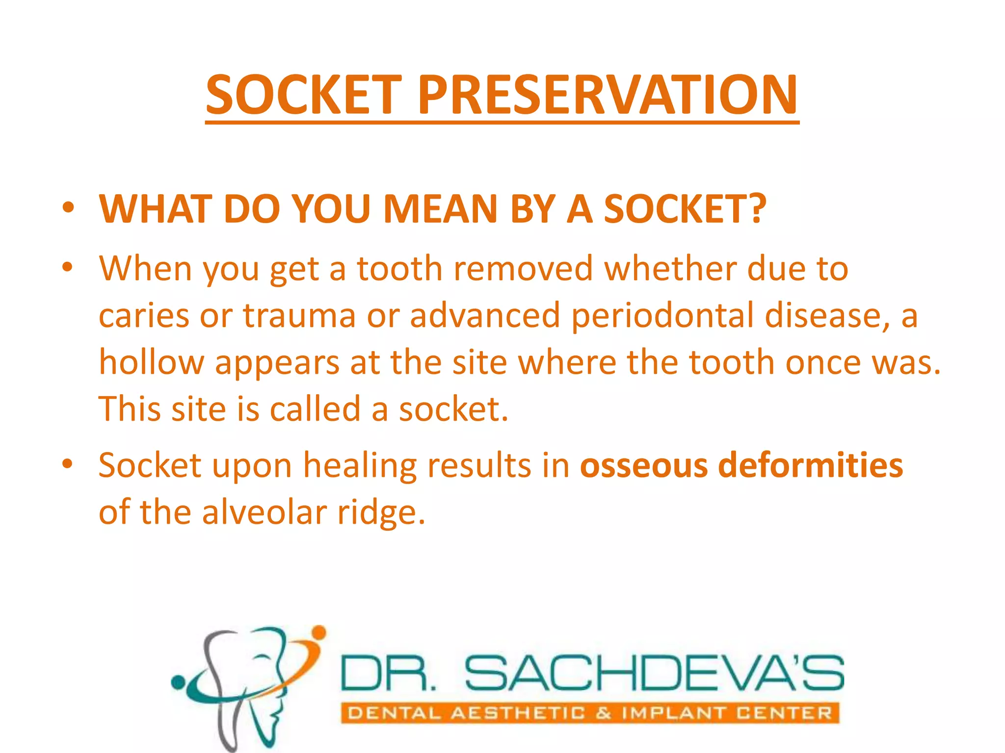 Socket Preservation | Ridge Preservation | PPTX