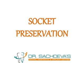 Socket Preservation | Ridge Preservation | PPTX
