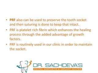 Socket Preservation | Ridge Preservation | PPTX