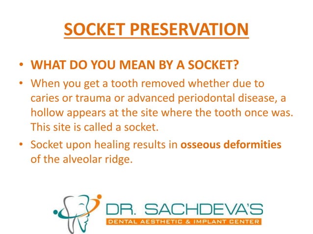 Socket Preservation | Ridge Preservation | PPTX | Dental Health ...