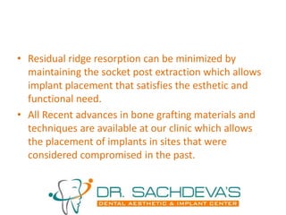 Socket Preservation | Ridge Preservation | PPTX