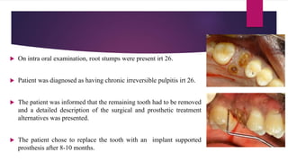 SOCKET PRESERVATION TECHNIQUE- A Case Presentation.pptx
