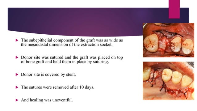 SOCKET PRESERVATION TECHNIQUE- A Case Presentation.pptx