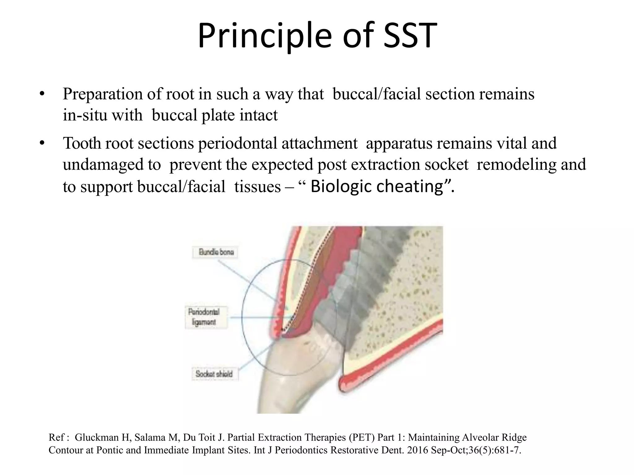Socket Shield Technique Pptx