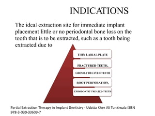 SOCKET SHIELD TECHNIQUE | PPTX