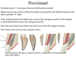 SOCKET SHIELD TECHNIQUE | PPTX