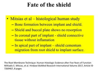 SOCKET SHIELD TECHNIQUE | PPTX