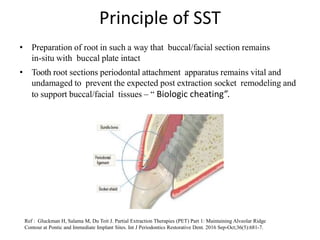 SOCKET SHIELD TECHNIQUE | PPTX