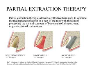 SOCKET SHIELD TECHNIQUE | PPT