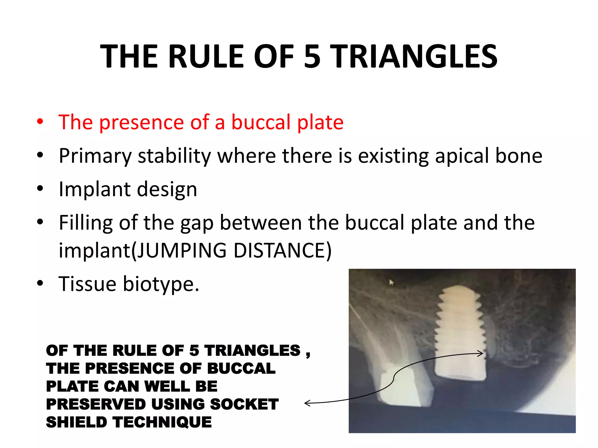 Socket shield technique | PPTX