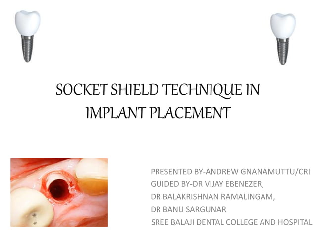 Socket shield technique | PPTX