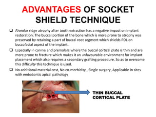 Socket shield technique | PPTX