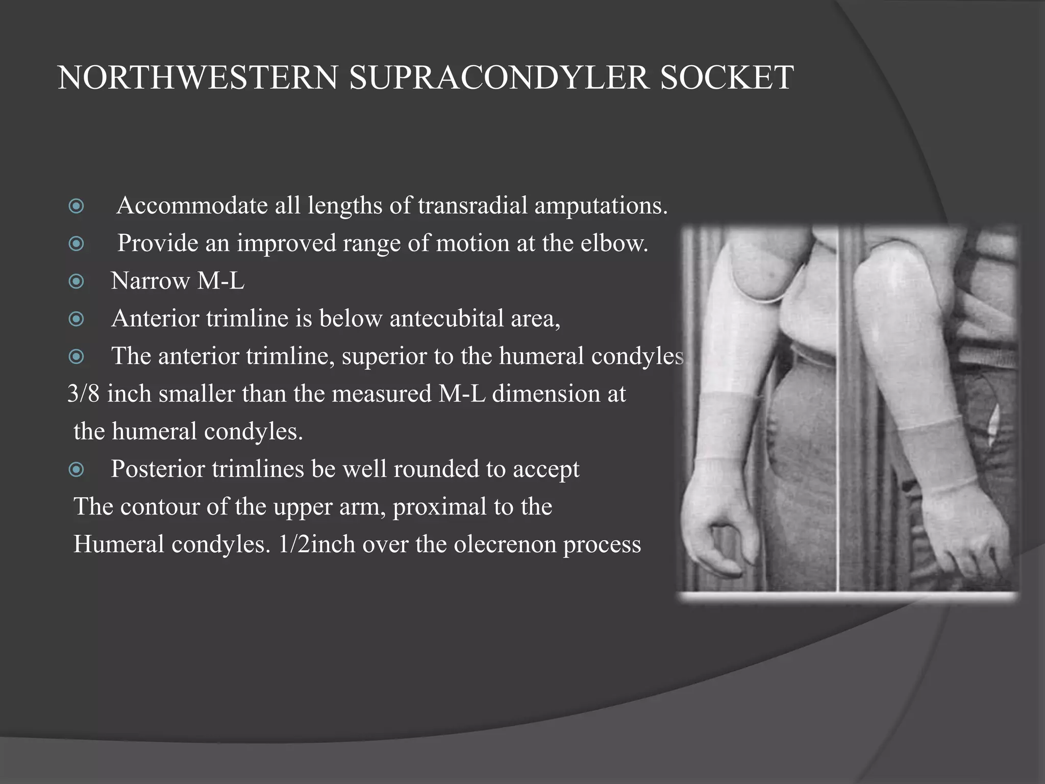 Socket variants in upper extremity prosthesis.pptx1 | PPTX