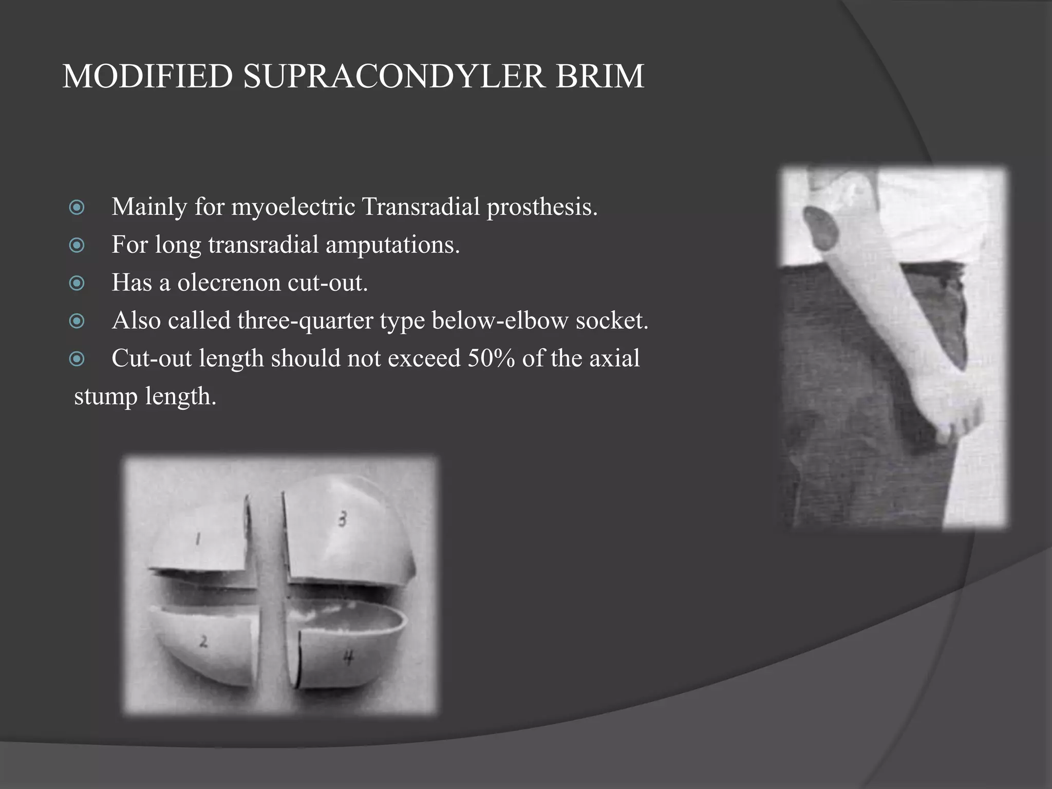 Socket variants in upper extremity prosthesis.pptx1 | PPTX