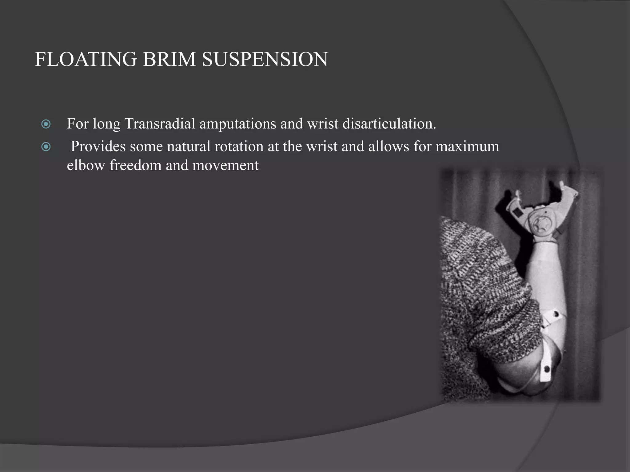 Socket variants in upper extremity prosthesis.pptx1 | PPTX