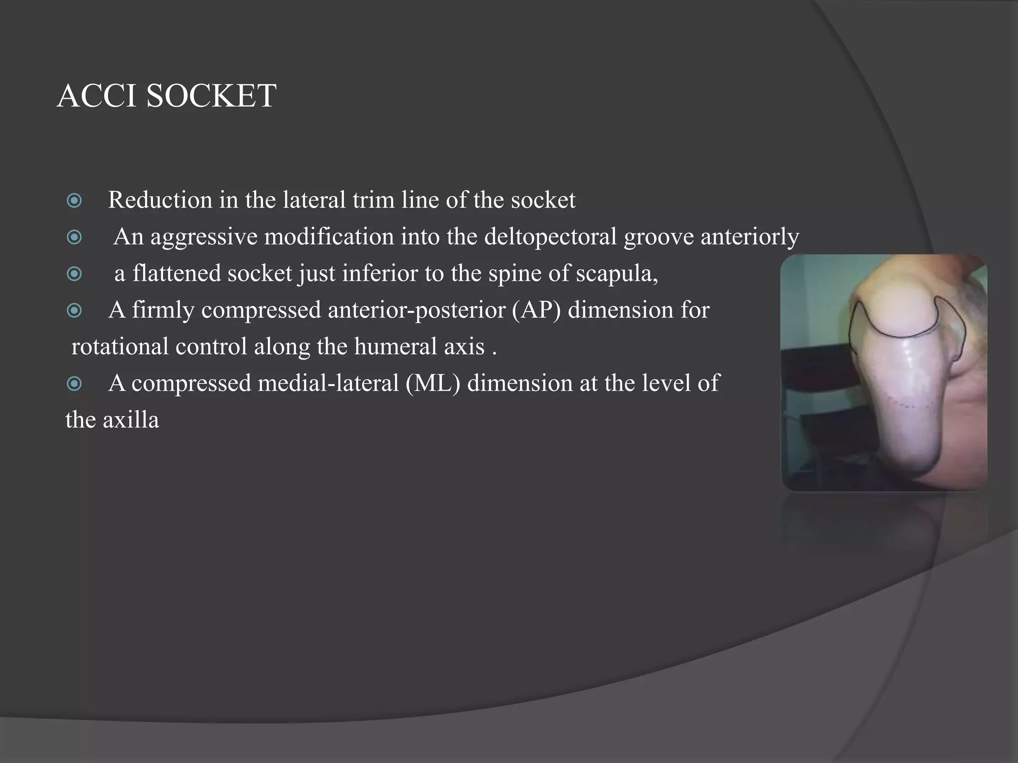 Socket variants in upper extremity prosthesis.pptx1 | PPTX