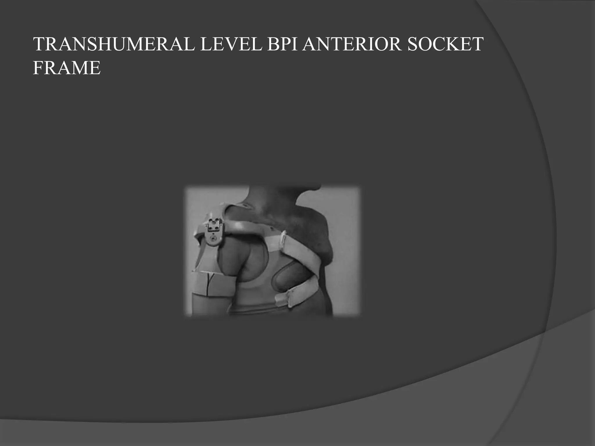 Socket variants in upper extremity prosthesis.pptx1 | PPTX