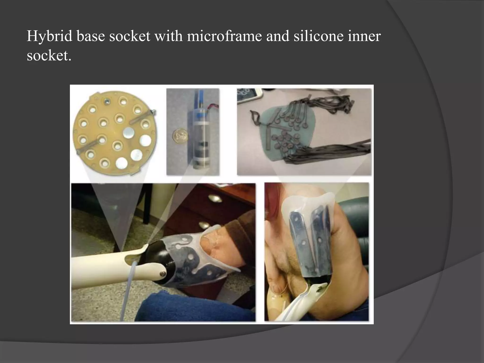 Socket variants in upper extremity prosthesis.pptx1 | PPTX