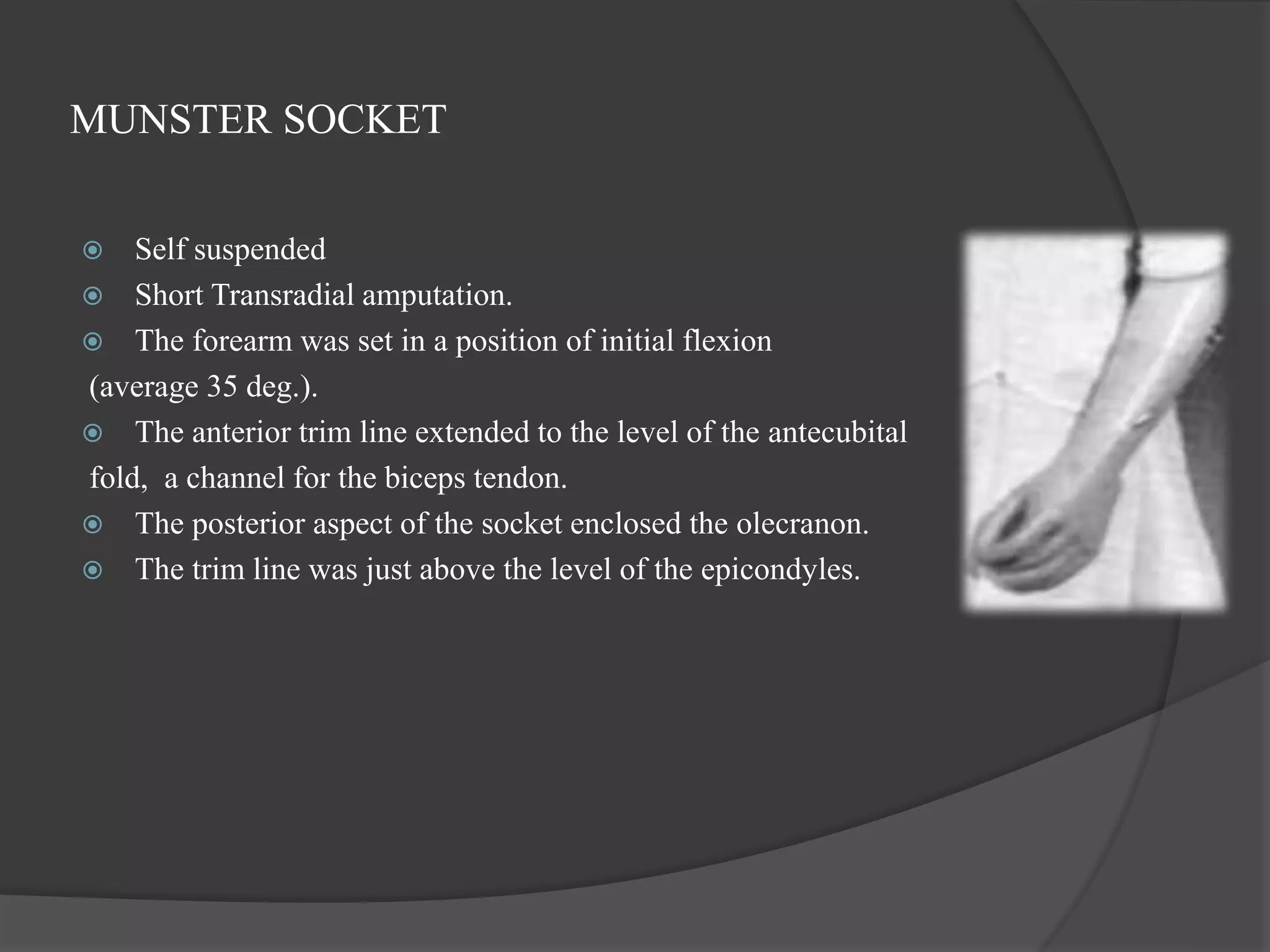 Socket variants in upper extremity prosthesis.pptx1 | PPTX