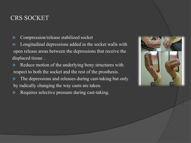 Socket variants in upper extremity prosthesis.pptx1 | PPTX