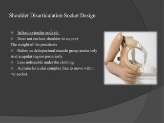 Socket variants in upper extremity prosthesis.pptx1 | PPTX