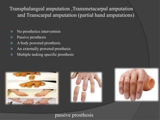 Socket variants in upper extremity prosthesis.pptx1 | PPTX