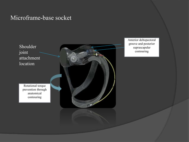 Socket variants in upper extremity prosthesis.pptx1 | PPTX