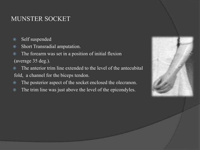 Socket variants in upper extremity prosthesis.pptx1 | PPTX