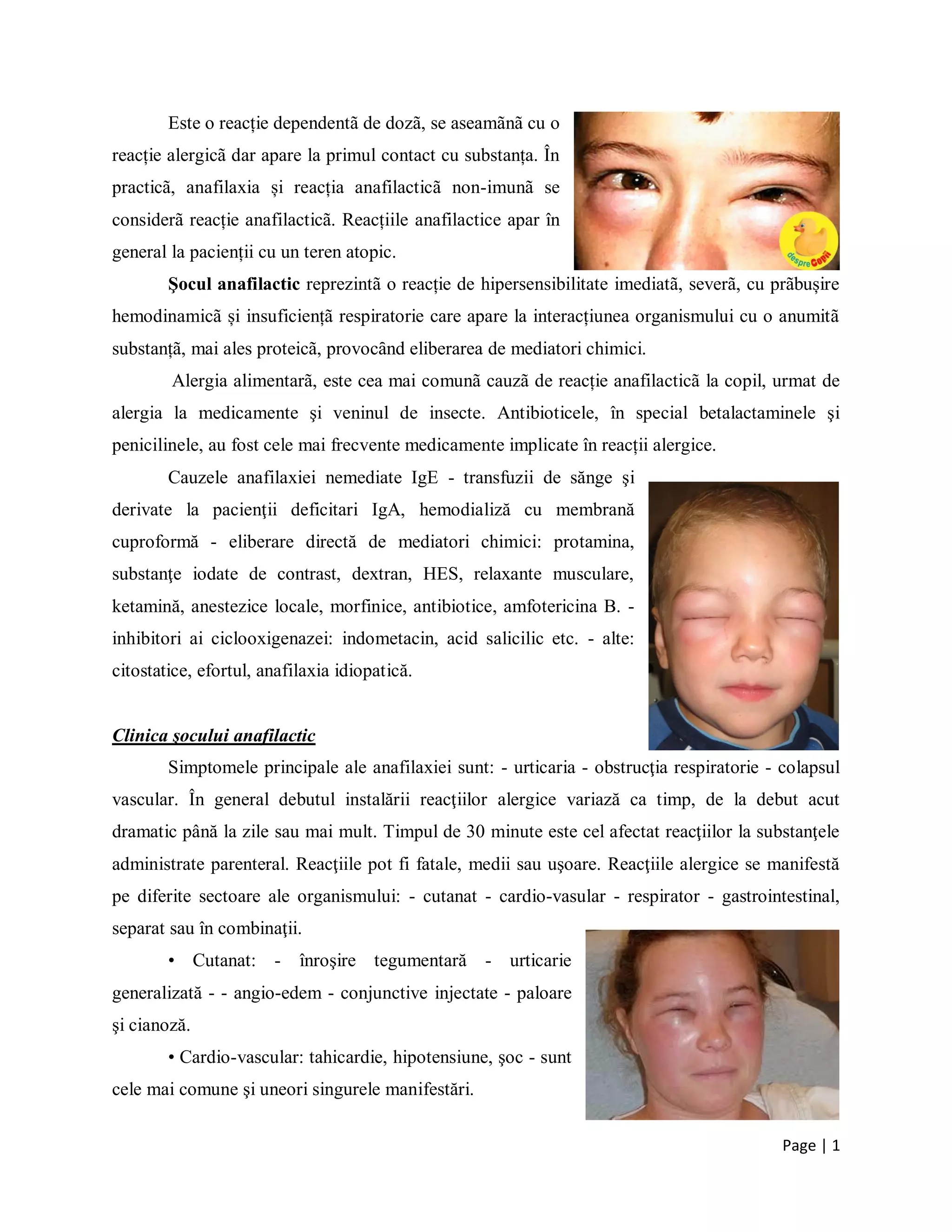 Socul anafilactic | PDF