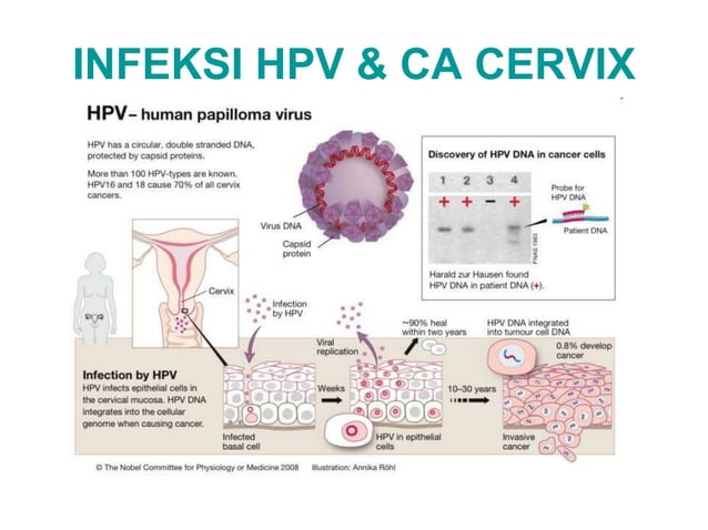 sodapdf-converted.pptx