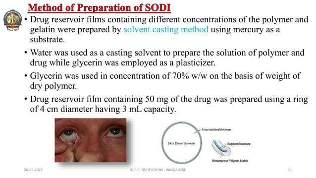 SODI(Soluble Ocular Drug Insert).pptx | Eye and Vision Conditions ...