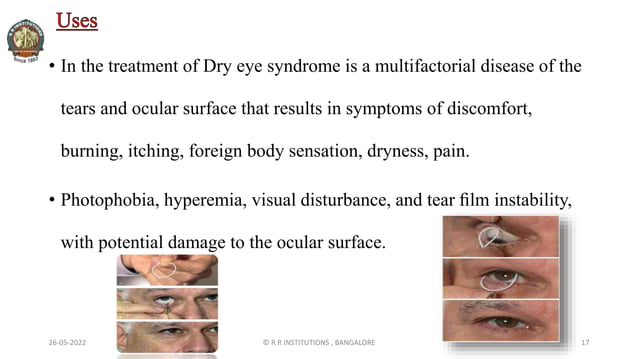 SODI(Soluble Ocular Drug Insert).pptx | Eye and Vision Conditions ...