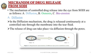 SODI(Soluble Ocular Drug Insert).pptx