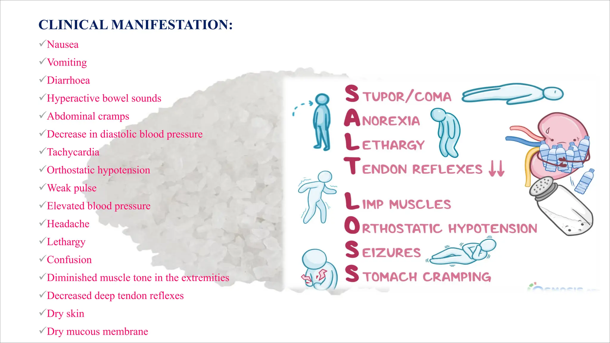 SODIUM - ELECTROLYTE IMBALANCE (HYPONATREMIA & HYPERNATREMIA) .pdf