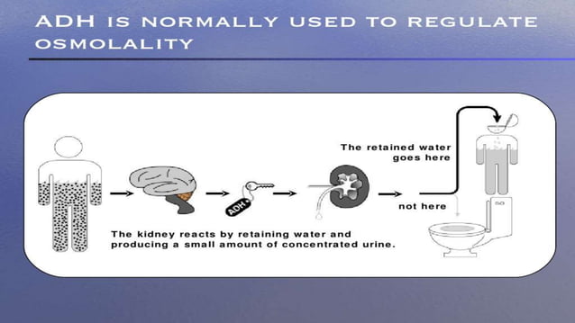 Sodium and water disorders | PPTX | Hormonal Disorders | Endocrine and ...