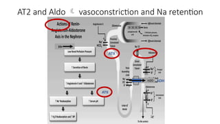 Sodium Disorders........................... | PPTX