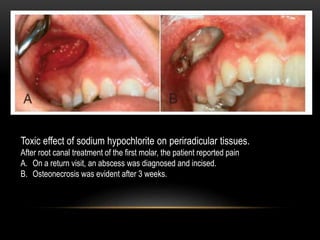 Sodium hypochlorite | PPT