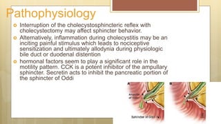 Sods sphincter of Oddi Dysfunction | PPTX